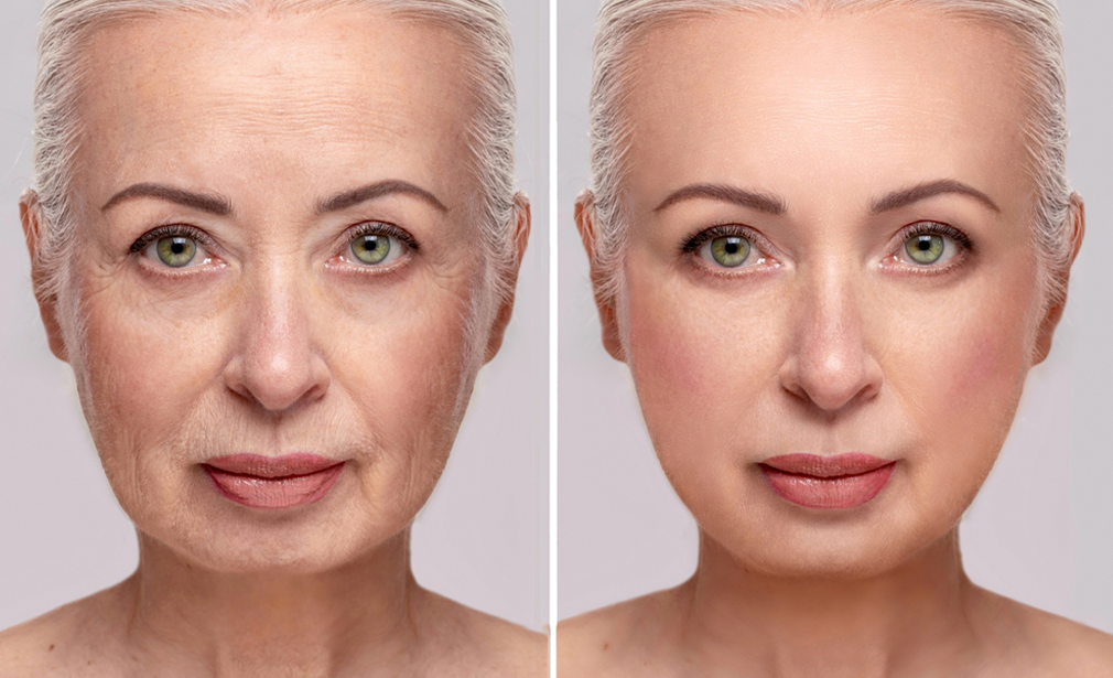 Body Shaping and skin tighten – Aoun Medical Center